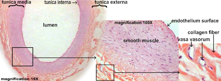 Anatomy of an Artery