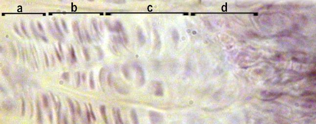 Epiphysis 4 - end of long bone