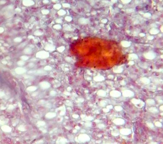 Cells of the Corpus Luteum